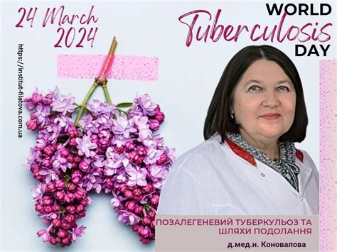 Extrapulmonary Tuberculosis And Ways To Treat It • State Institution ‘the Filatov Institute Of