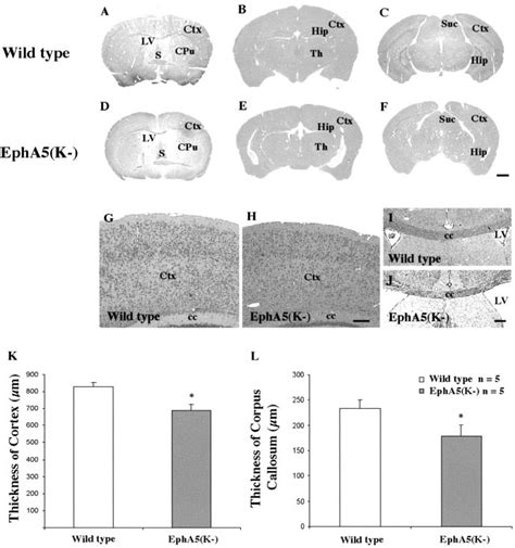 Morphological Changes Of The Cerebral Cortex And The Corpus Callosum In Download Scientific