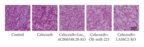 Celecoxib Exerts Antitumor Effect Through Lnc Download Scientific
