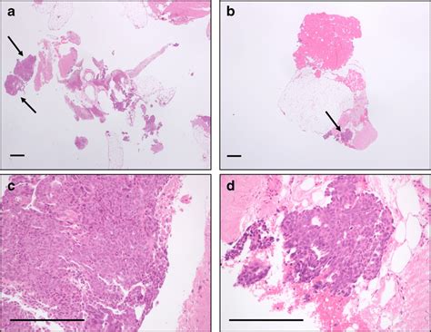 Histological Analysis Of Biopsy Material From Patient 5 From Two Download Scientific Diagram