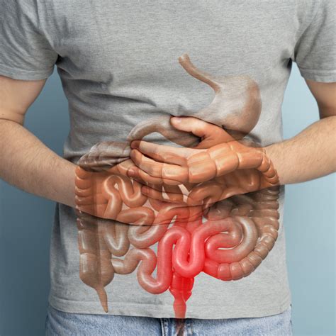Early Onset Colorectal Cancer Risk Factors And Diagnosis Fomat