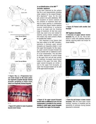MBT TECHNIQUE ORTHODONTIC EDUCATION FOR GENERAL PRACTITIONERS PDF