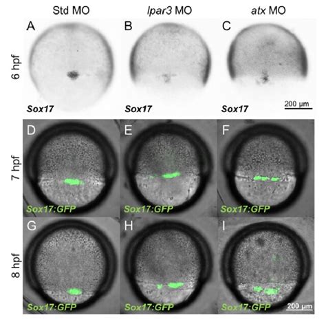 Dfc Clustering Is Disturbed In Lpar3 And Atx Morphants During Epiboly Download Scientific