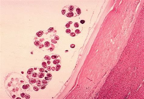 Free Picture Histopathology Echinococcus Granulosus Hydatid Cyst Sheep