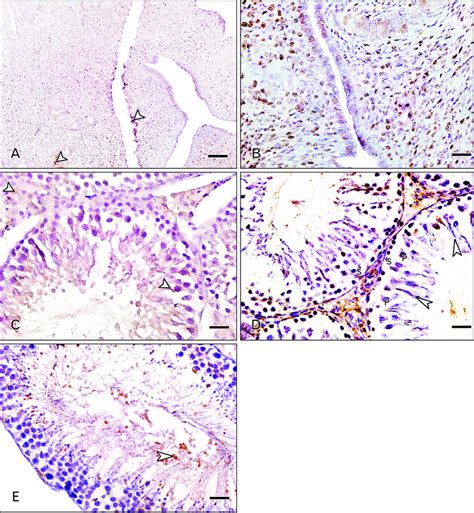 Photomicrographs Of Sections Stained With Immunohistochemistry For