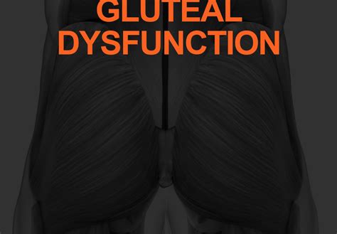Recognizing And Correcting Gluteal Dysfunction Personal Trainer Today