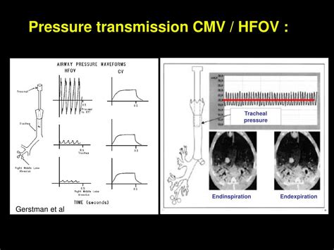 Ppt What Is Hfov Specific Characteristics Of Hfov Powerpoint