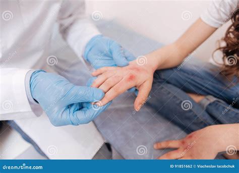 Jong Kind Die Een Allergische Reactie Hebben Stock Foto Image Of