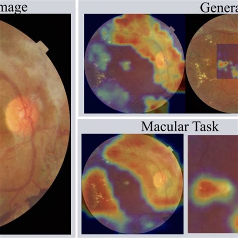 Class Activation Maps Cam Of A Challenging Multi Label Sample Cam Download Scientific