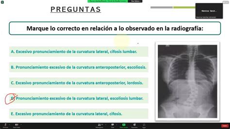 Radiografias George Esteban Udocz