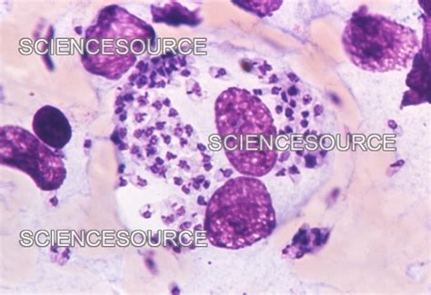 Visceral Leishmaniasis Under A Microsc Stock Image Science Source