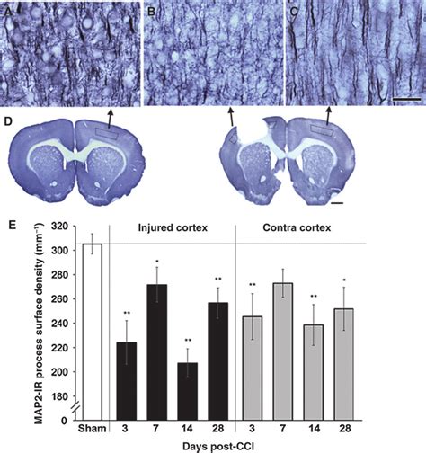 The Density Of Dendritic Arbors Microtubule Associated Protein 2
