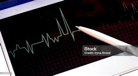 医療心臓測量心臓のセラペヒト医脈拍グラフ心臓の物理的な心拍数の測定 コンセプトのストックフォトや画像を多数ご用意 コンセプト