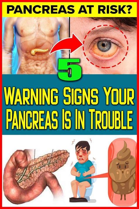 5 Warning Signs Your Pancreas Is In Trouble Pancreas Warning Signs