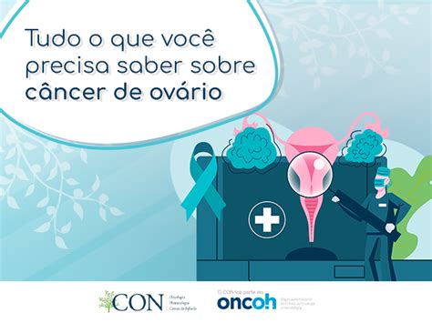 Tudo O Que Você Precisa Saber Sobre Câncer De Ovário Con Oncologia