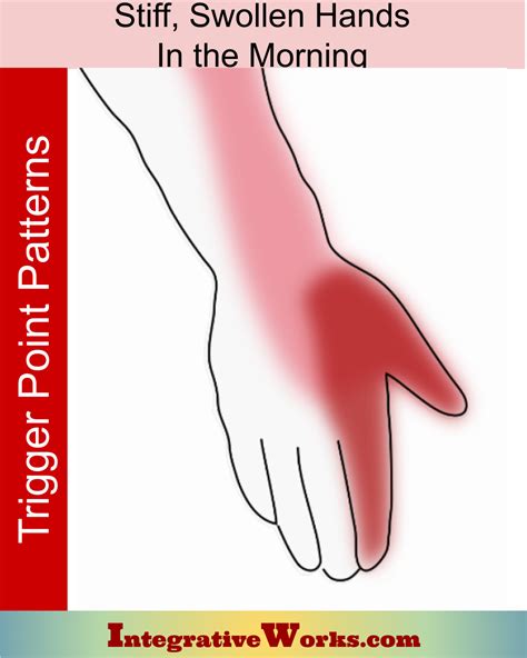 Stiff Swollen Hands In The Morning Integrative Works
