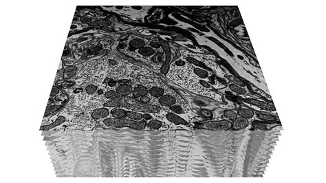 Serial Block Face Sem Application Examples