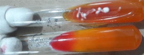 Trichophyton Mentagrophytes On Dermatophyte Test Media Download