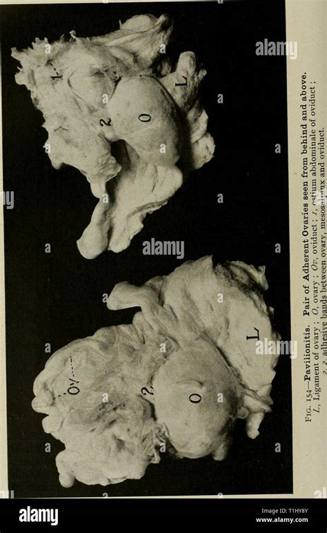 The Diseases Of The Genital Stock Photo Alamy