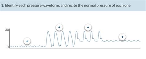 Pa Catheter Waveform Diagram Quizlet