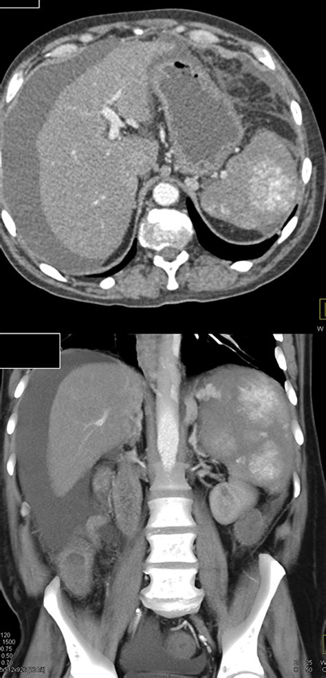 Gastrointestinal Learning Modules Ct Scanning