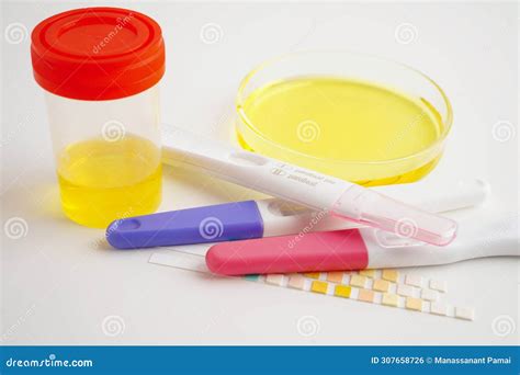 Urinalysis Urine Cup With Reagent Strip Ph Paper Test And Comparison