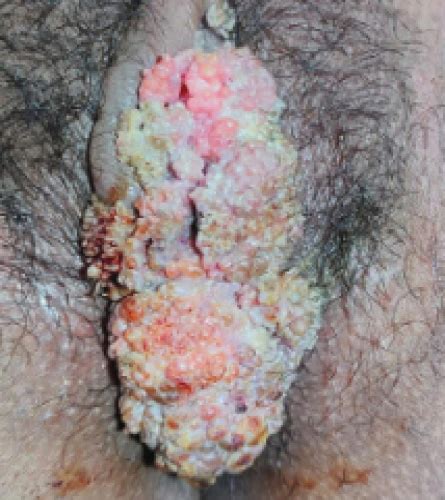 Oman Medical Journal Archive