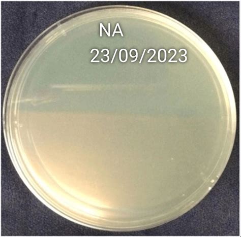 Microbiology Vijaykumar Hanumantharaya