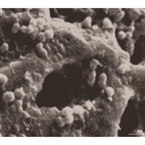 Sem Micrographs Of Root Canal Walls And Dentinal Tubules Control