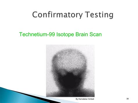 Brain Death Assessment Basic Principles Ppt