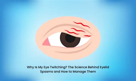 Why Is My Eye Twitching Causes And Solutions Explained