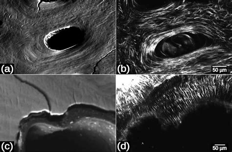 High Resolution Cross Sections Of Pores In Fig 3b And C Revealing The Download Scientific