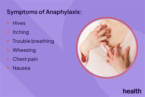 Anaphylaxis Signs And Symptoms