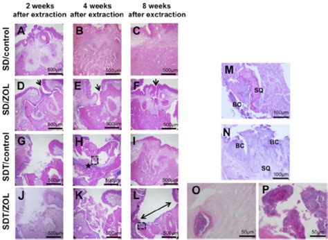 Photomicrographs Of Extraction Sockets In Sd Control A C Sd Zol