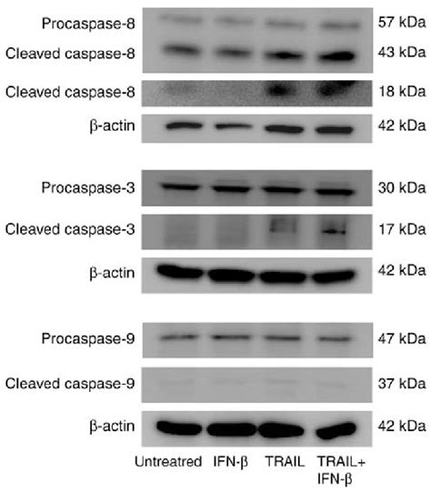 Apoptotic Pathway Induction By Trail Andor Ifn β Western Blot