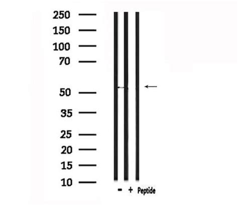 Gpr37l1 Polyclonal Antibody Pa5 106838