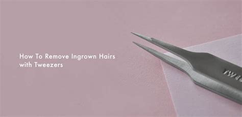 How To Remove Ingrown Hairs With Tweezers