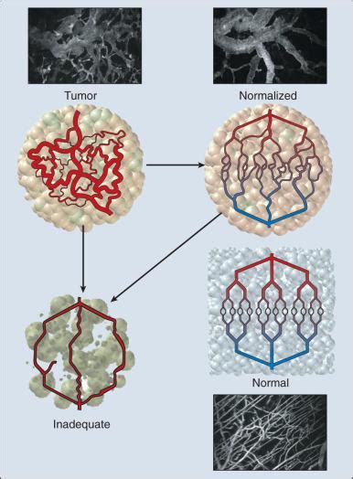 Tumor Microenvironment Vascular And Extravascular Compartment