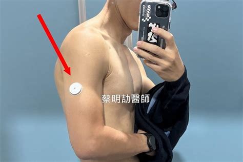 連續血糖監測cgm文章整理