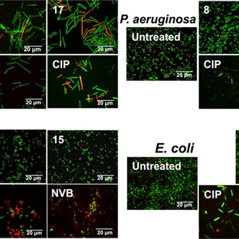 Bacterial Viability After Different Compound Treatments Bacterial