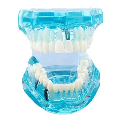 Teaching Tooth Model For Dental School M2001 Denta Grandado