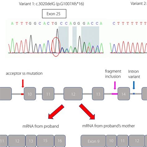 Pedigree Of The Proband And Genetic Analysis Of The WRN Gene A