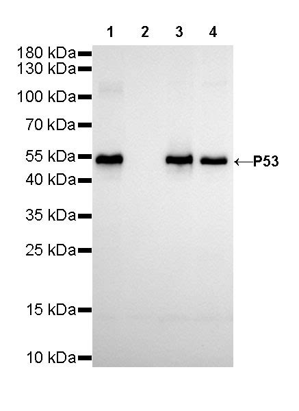 S Rmab® P53 Recombinant Rabbit Mab Sdt R118p04637斯达特公司官网
