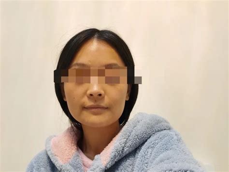 黄皮肤怎么有效美白