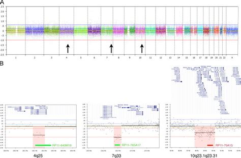 High Resolution Oligo Based Acgh Analysis A Whole Genome Profile