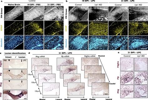 Figures And Data In Lrp1 Regulates Peroxisome Biogenesis And