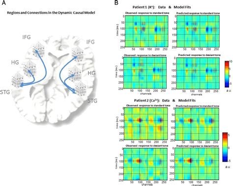 Optimized Dynamic Causal Models A The Event Related Fi Elds Were Download Scientific Diagram