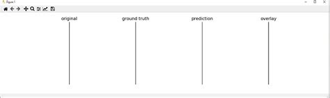 utils plot imgs returns an empty table · issue 28 · karolzak keras