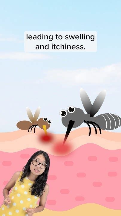 Why Do Sand Flies Bite You
