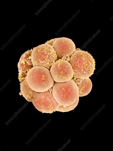 Coloured Sem Of Human Embryo At 16 Cell Stage Stock Image P6800390